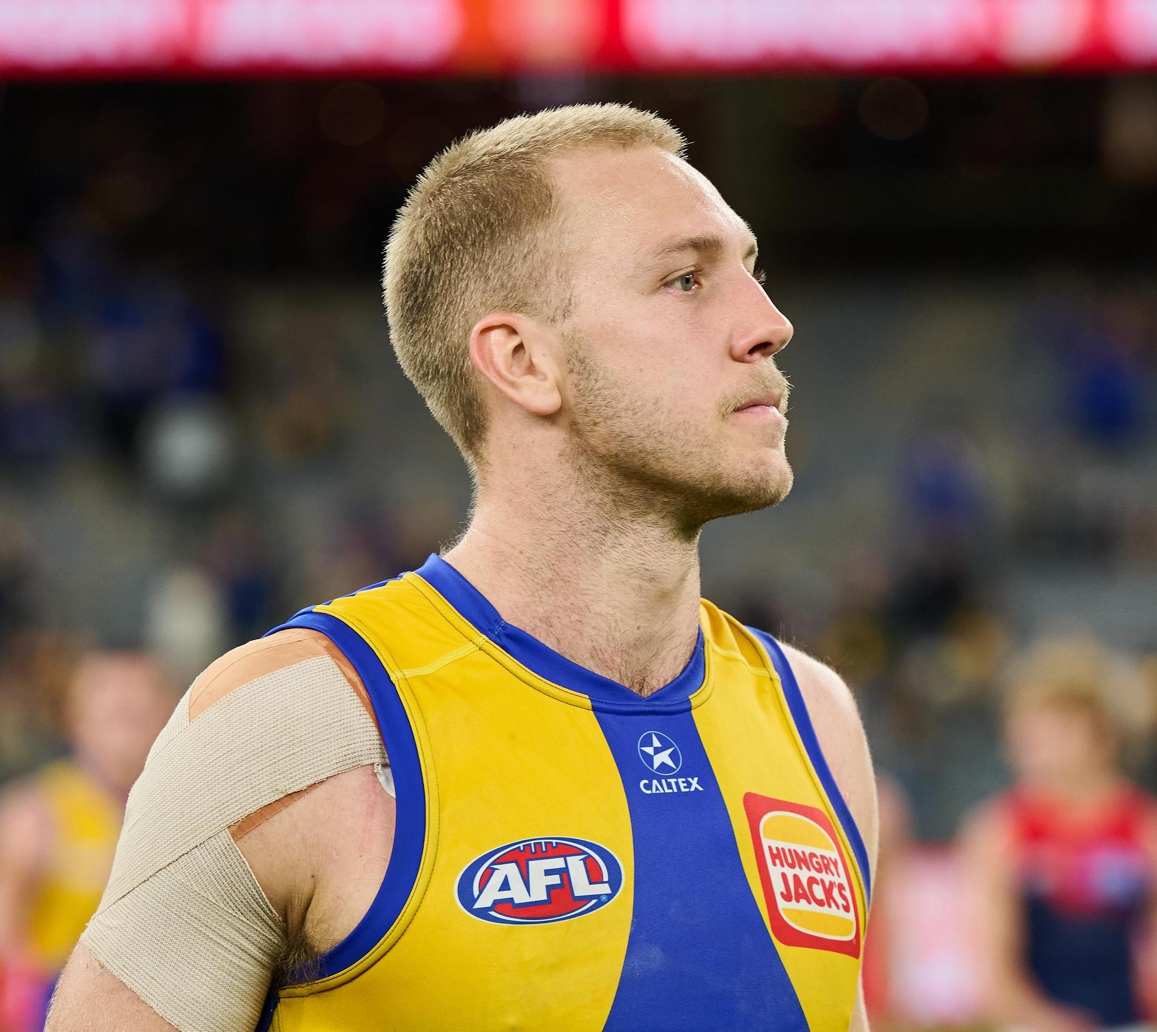 Allen undergoes knee surgery